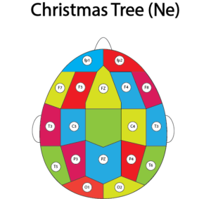 Extraverted Intuition – Personality In Depth